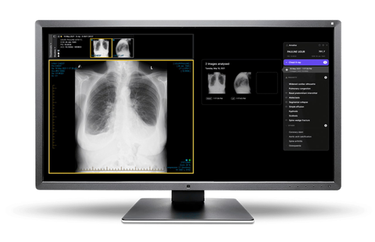 AI Medical Imaging | EGT
